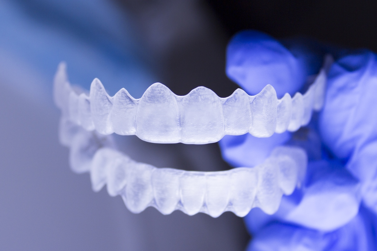 Benefits of invisible aligners - Natural and Healthy World